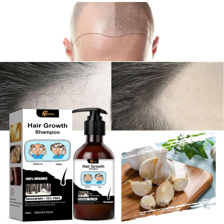Rodil Garlic Shampoo Herbal Essences Anti Dandruff Shampoo Anti Hair L